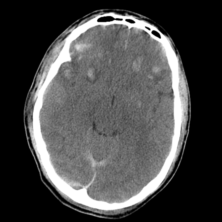 Case #6 - CaseStacks.com