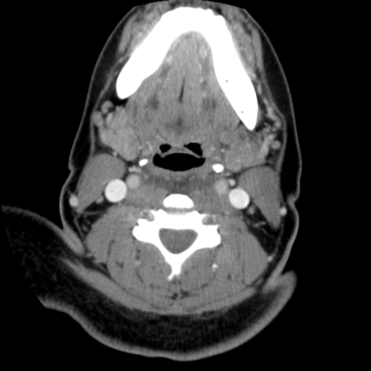 Case #8 - CaseStacks.com