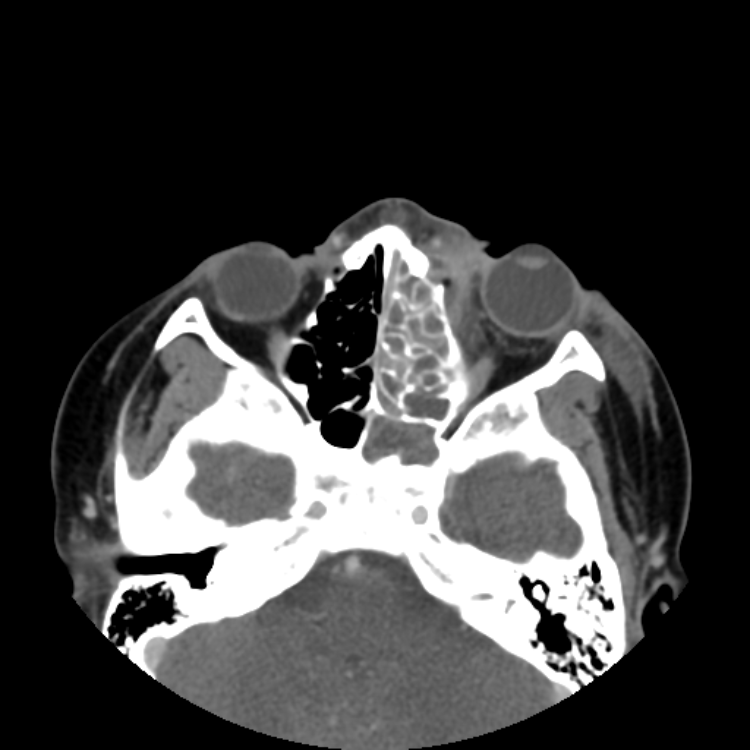 Case #15 - CaseStacks.com
