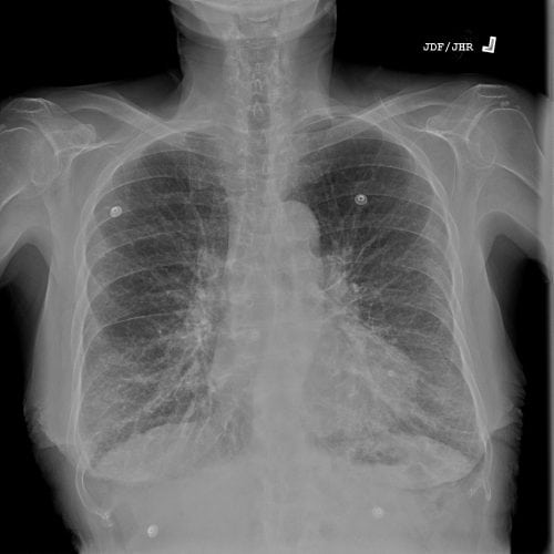 Case #11 - CaseStacks.com