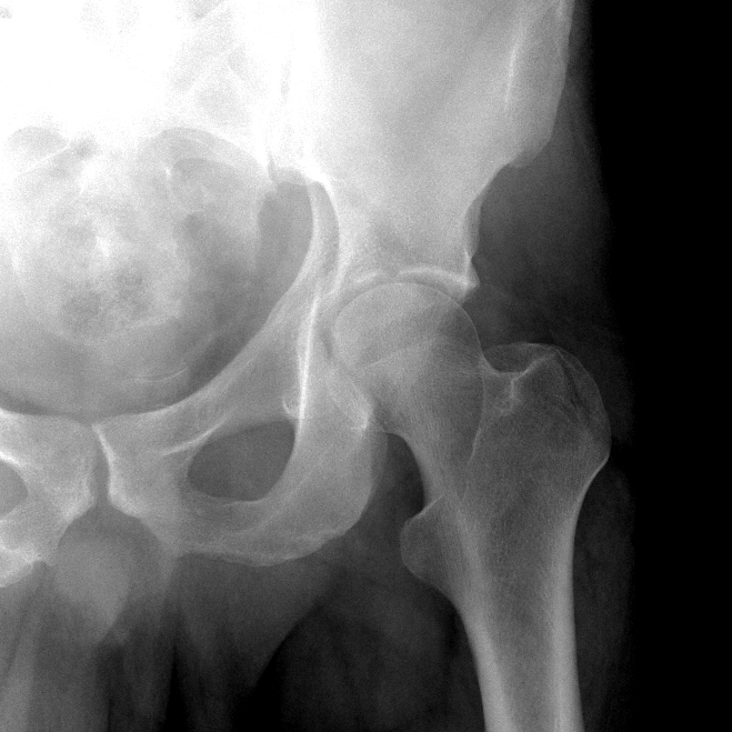 Case #10 - CaseStacks.com