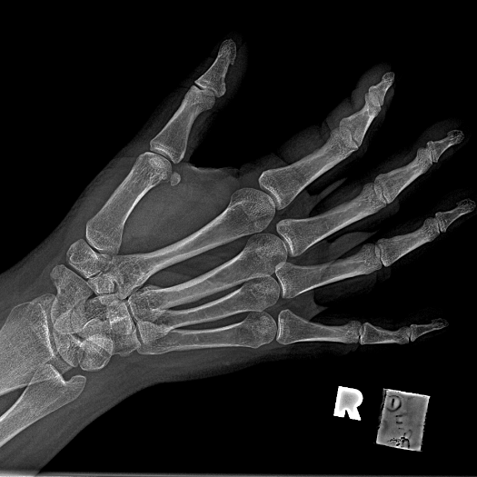 Case #19 - CaseStacks.com