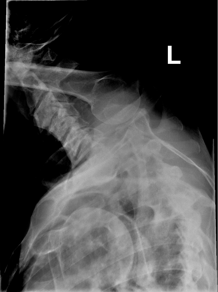 Case #24 - CaseStacks.com
