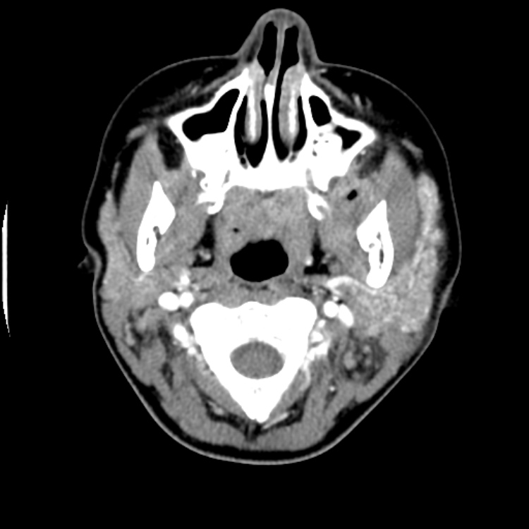 Case #10 - CaseStacks.com