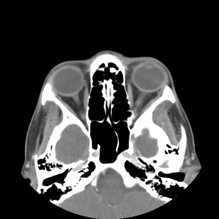 Case #13 - CaseStacks.com