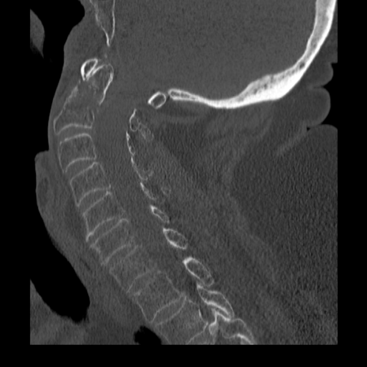 Case #6 - CaseStacks.com
