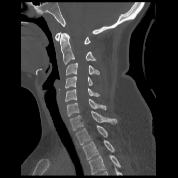 Case #7 - CaseStacks.com