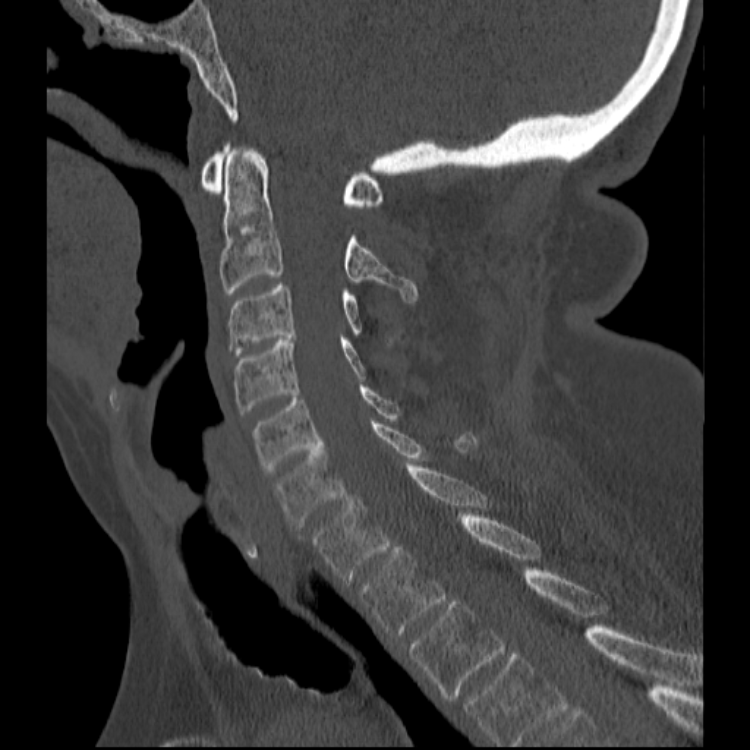 Case #9 - CaseStacks.com