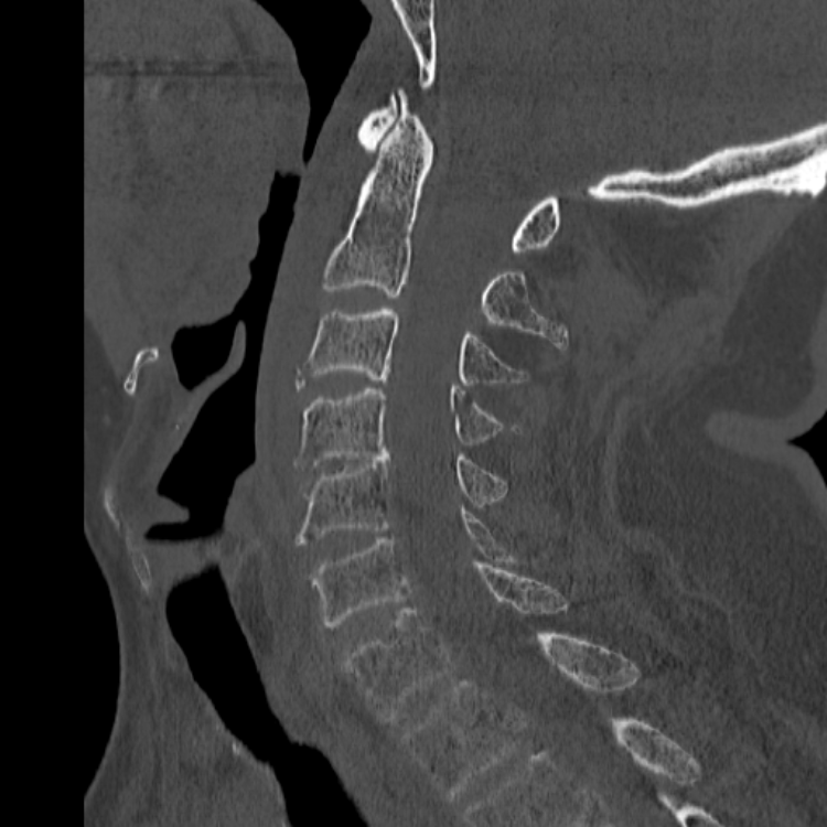 Case #15 - CaseStacks.com