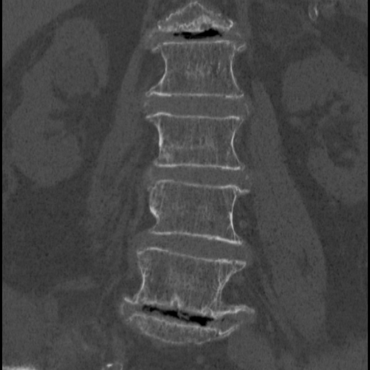Case #26 - CaseStacks.com