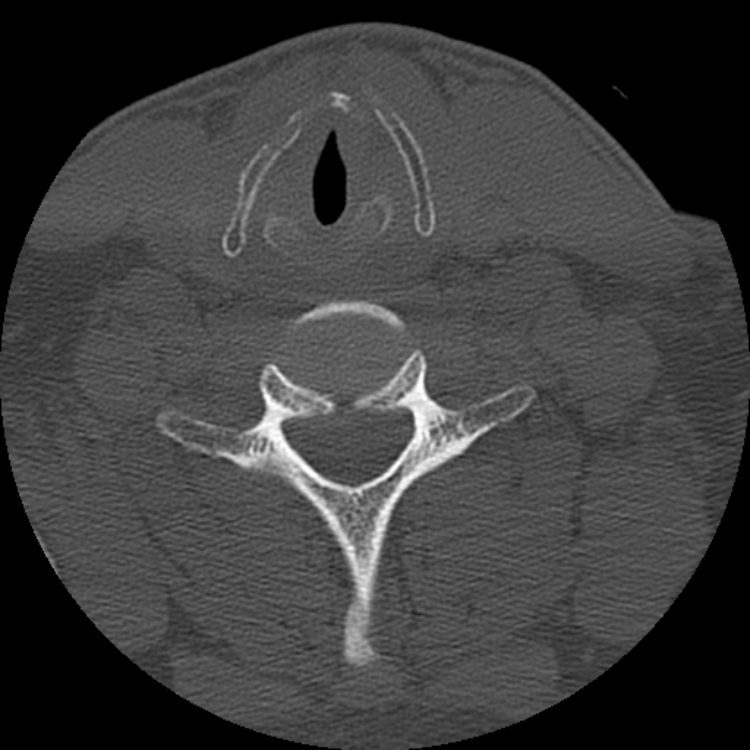 Case #29 - CaseStacks.com