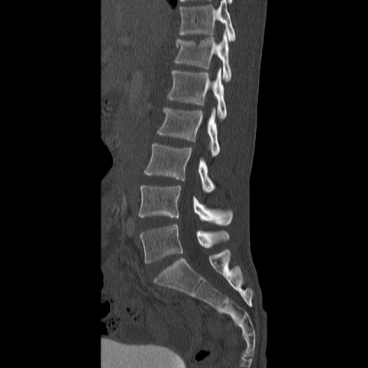 Case #15 - CaseStacks.com