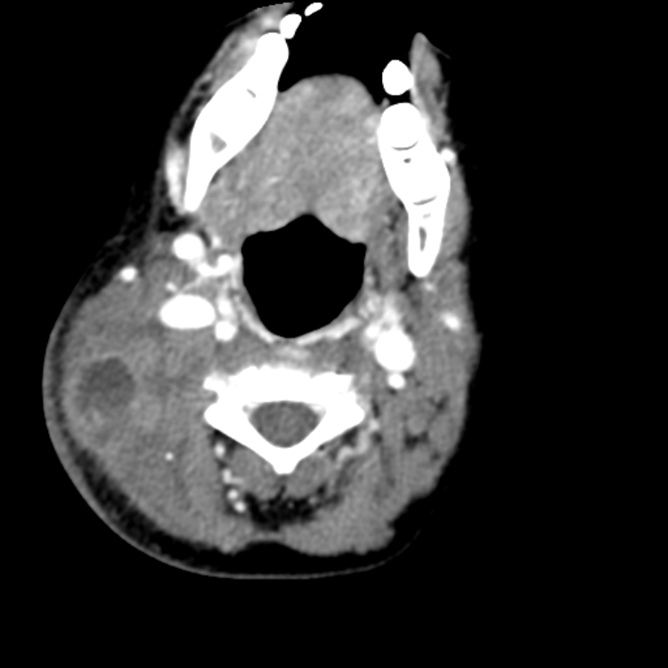 Case #6 - CaseStacks.com