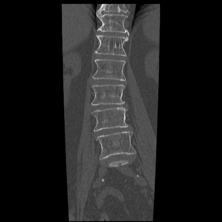 Case #20 - CaseStacks.com