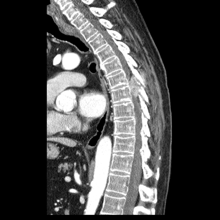 Case #19 - CaseStacks.com