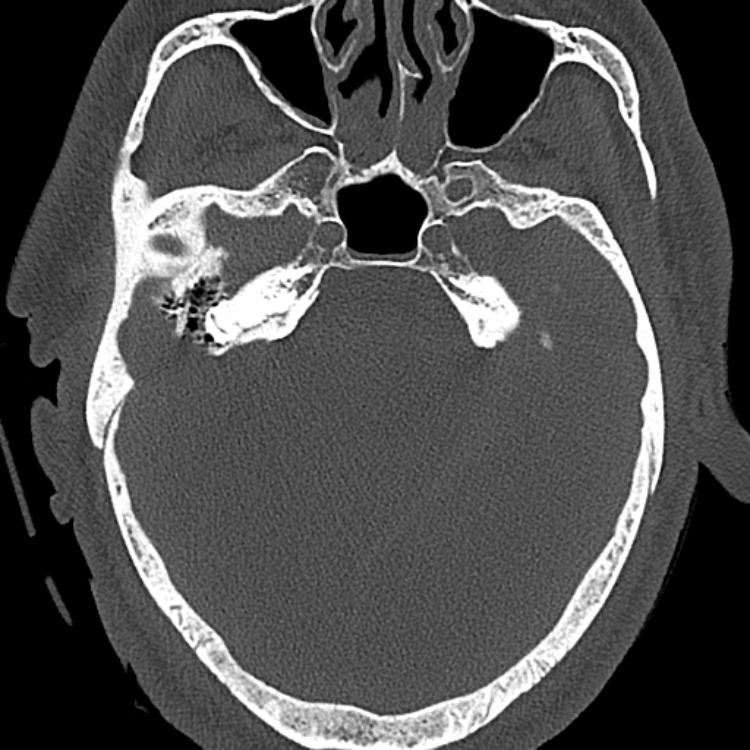 Case #4 - CaseStacks.com