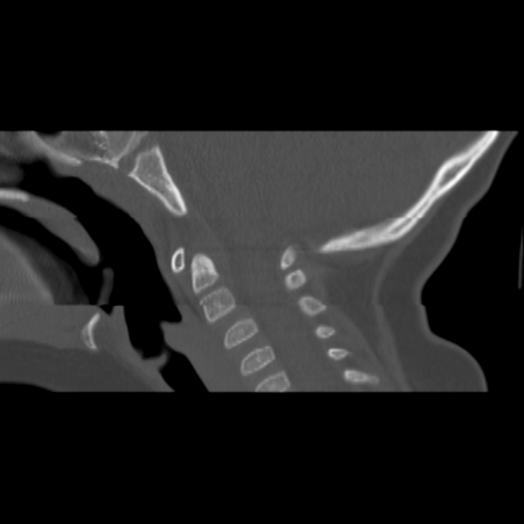 Case #14 - CaseStacks.com