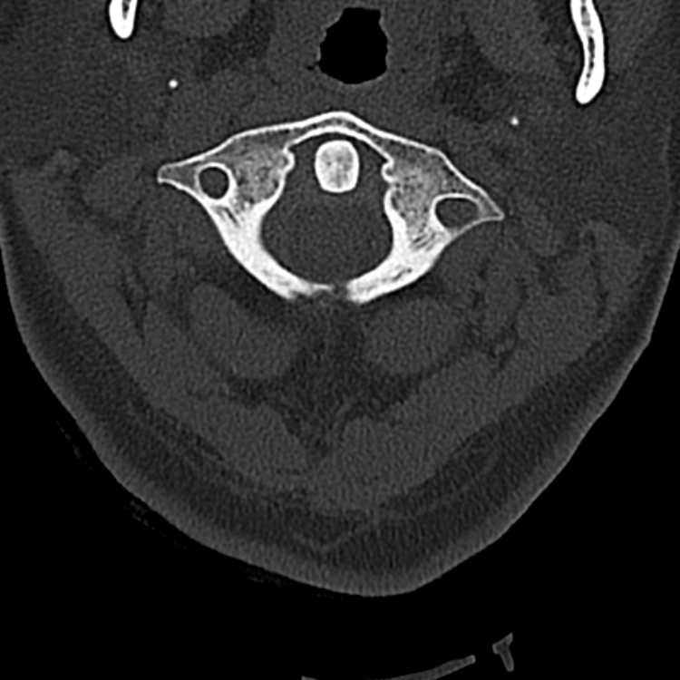 Case #8 - CaseStacks.com