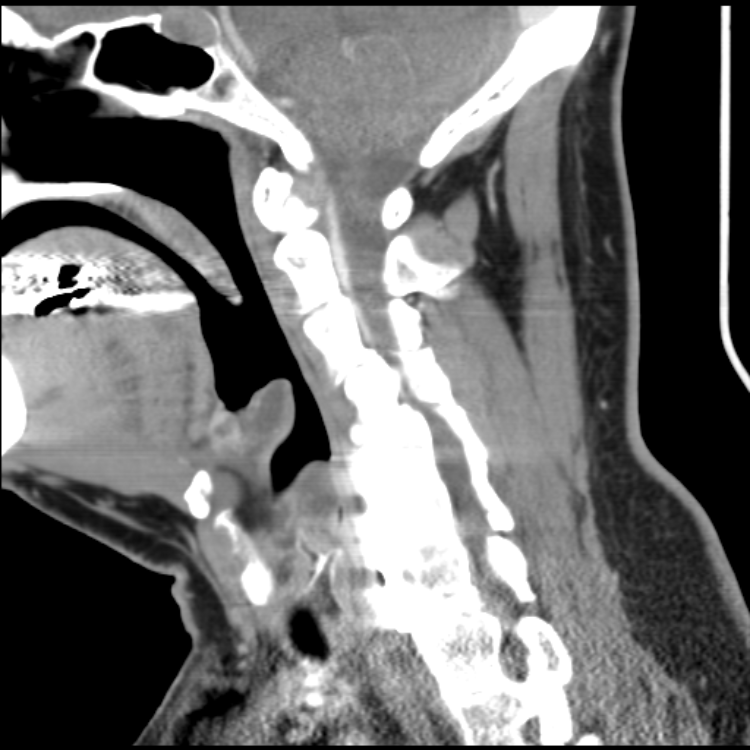 Case #8 - CaseStacks.com