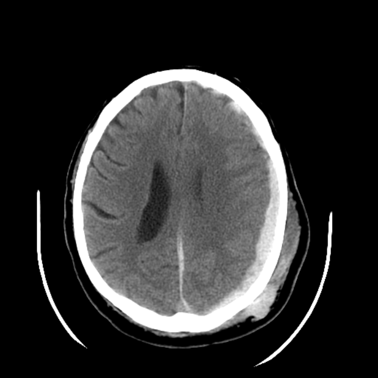 Case #3 - CaseStacks.com