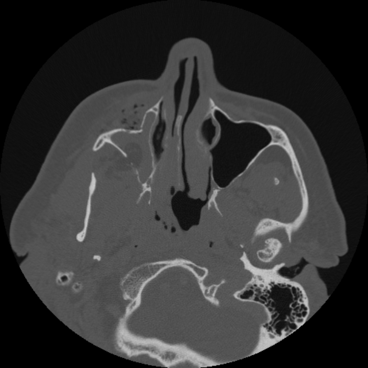 Case #16 - CaseStacks.com