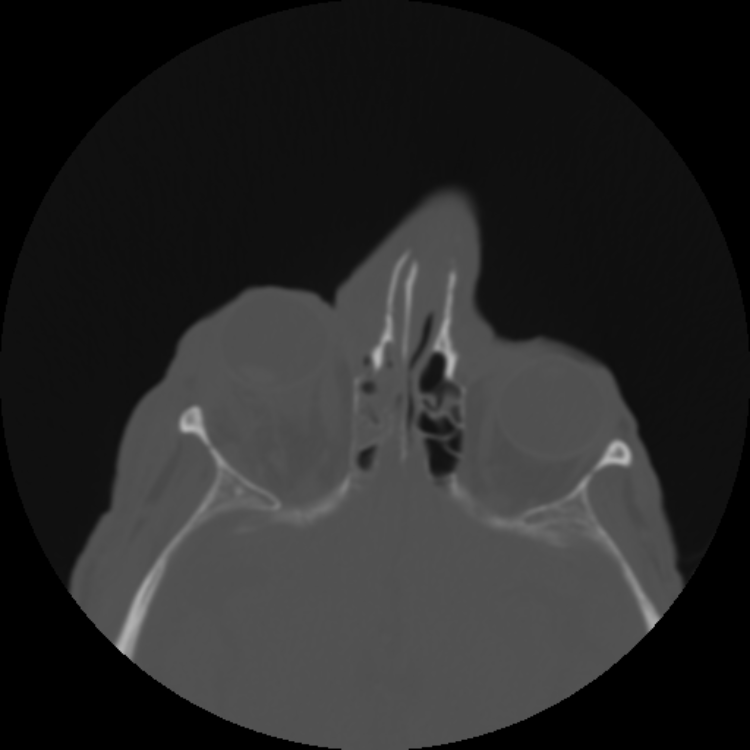 Case #5 - CaseStacks.com