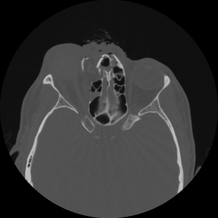 Case #8 - CaseStacks.com
