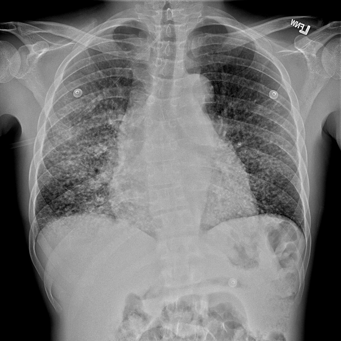 Case #20 - CaseStacks.com