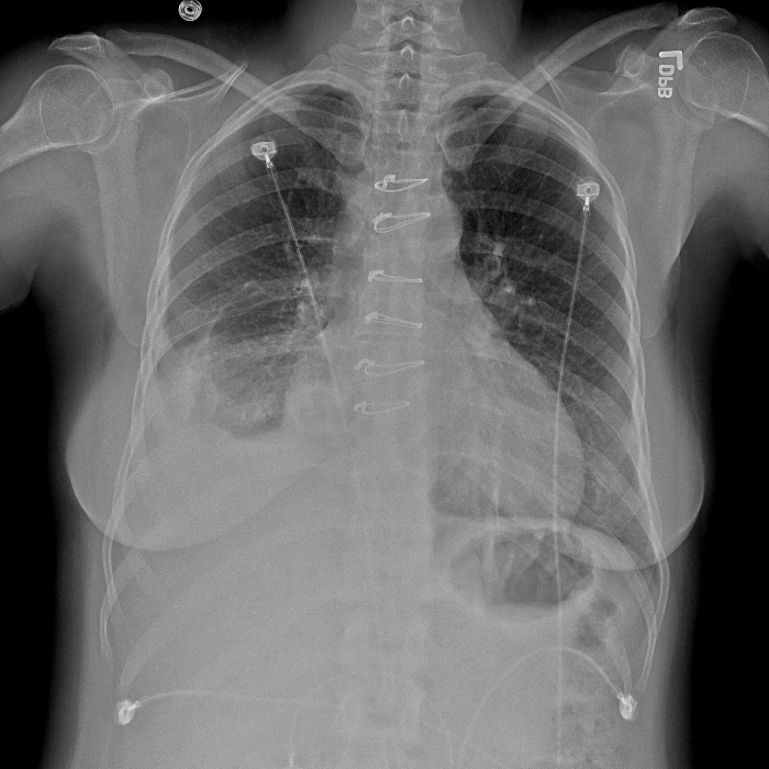 Case #8 - CaseStacks.com