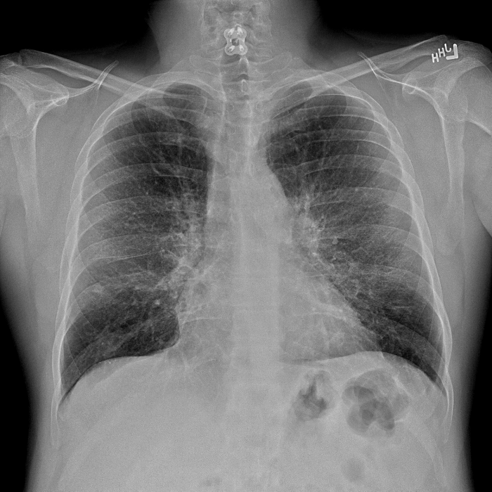 Case #13 - CaseStacks.com