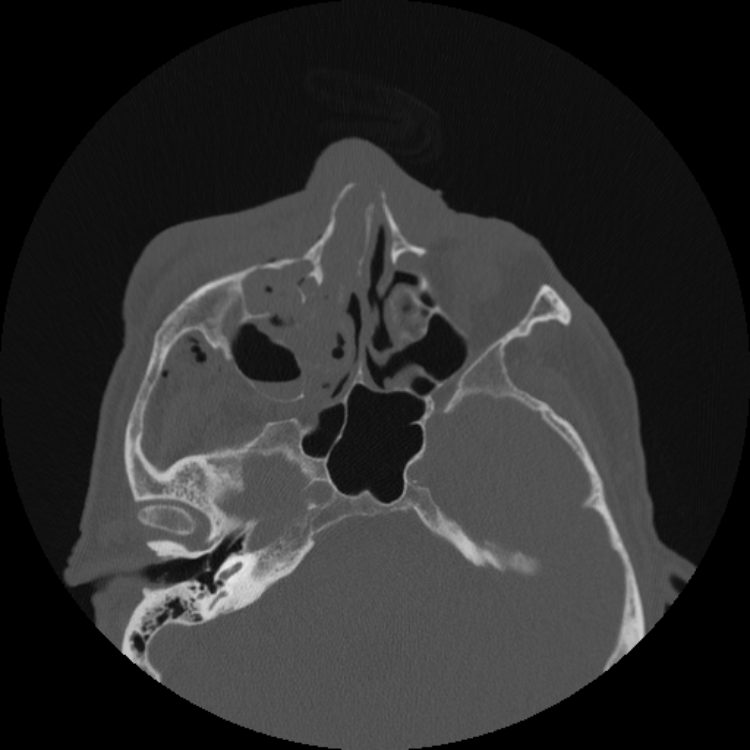 Case #13 - CaseStacks.com