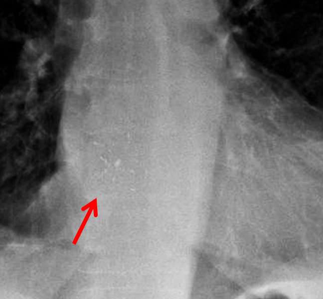 Cardiac | CaseStacks.com