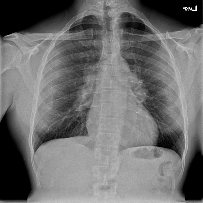 Case #10 - CaseStacks.com