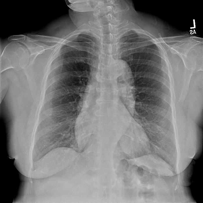 Case #16 - CaseStacks.com