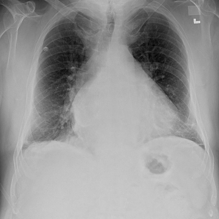 Case #37 - CaseStacks.com