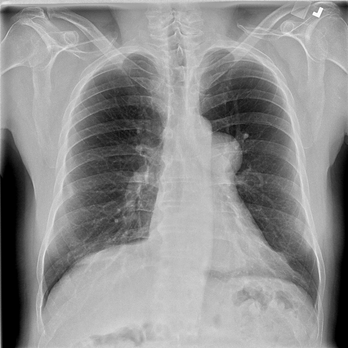 Case #2 - CaseStacks.com