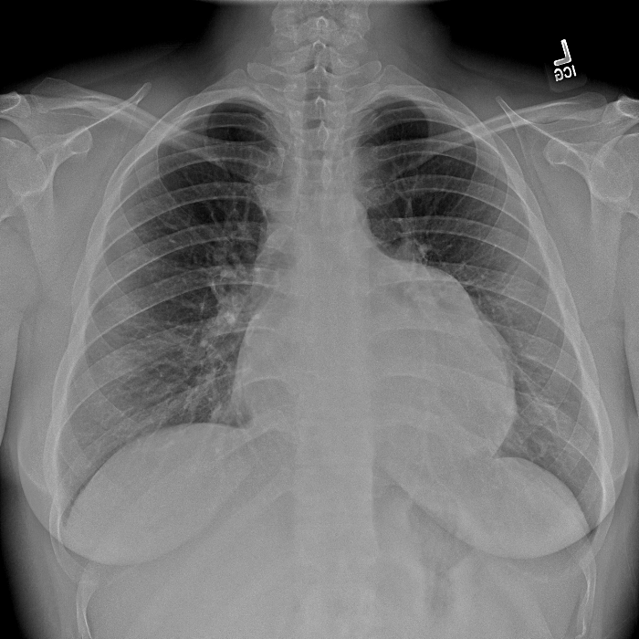 Case #4 - CaseStacks.com