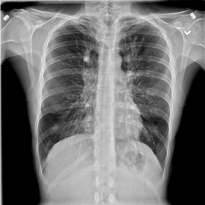 Case #23 - CaseStacks.com