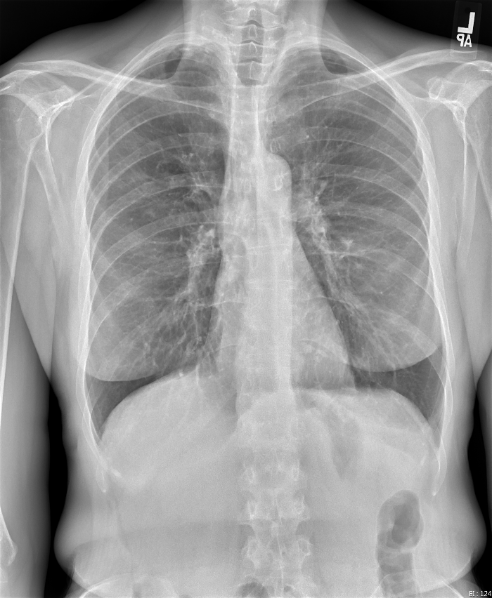 Case #46 - CaseStacks.com