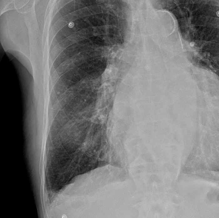 Case #5 - CaseStacks.com