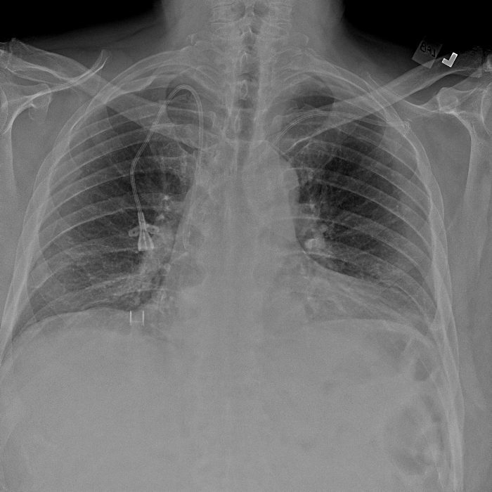 Case #49 - CaseStacks.com