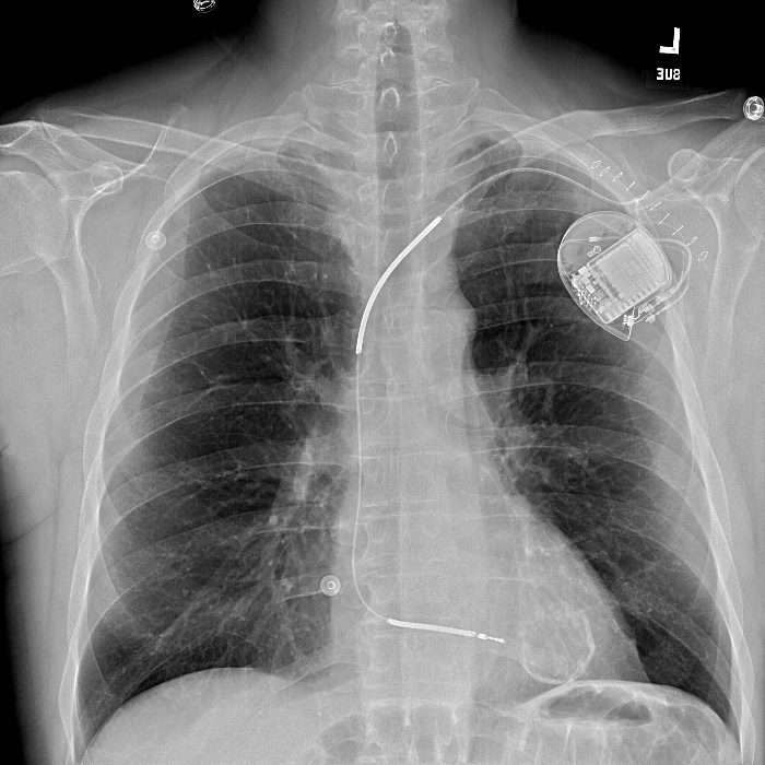 Case #6 - CaseStacks.com
