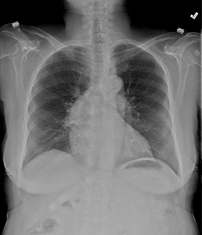 Case #9 - CaseStacks.com