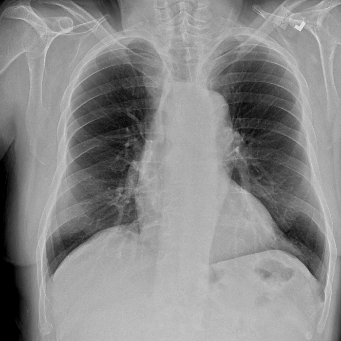 Case #13 - CaseStacks.com