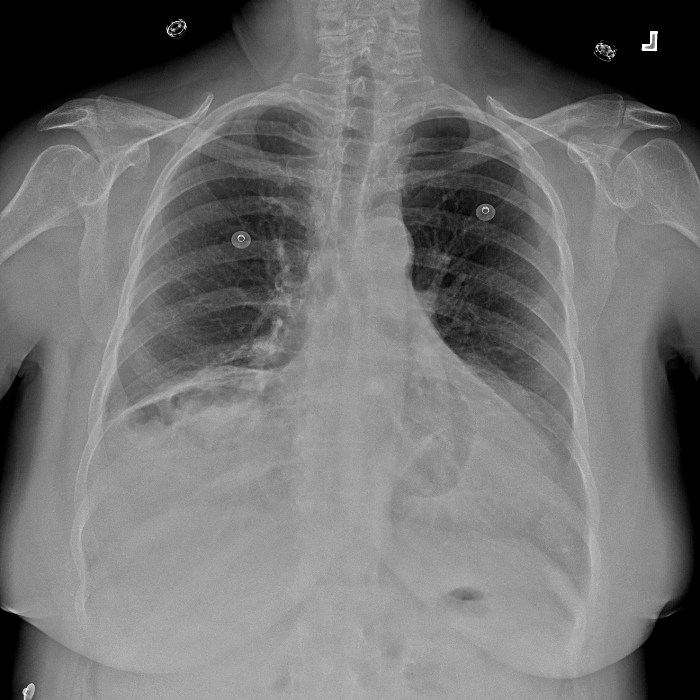 Case #14 - CaseStacks.com