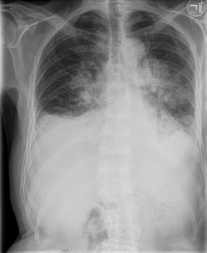 Case #38 - CaseStacks.com