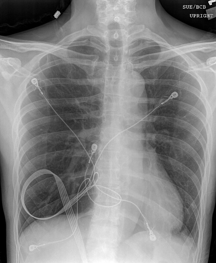 Case #8 - CaseStacks.com