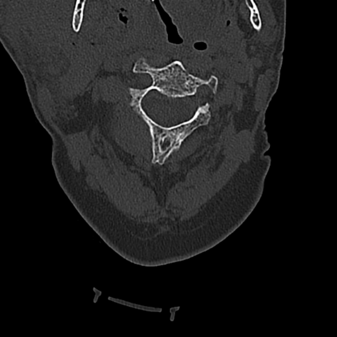 Case #14 - CaseStacks.com