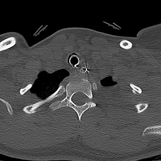 Case #4 - CaseStacks.com