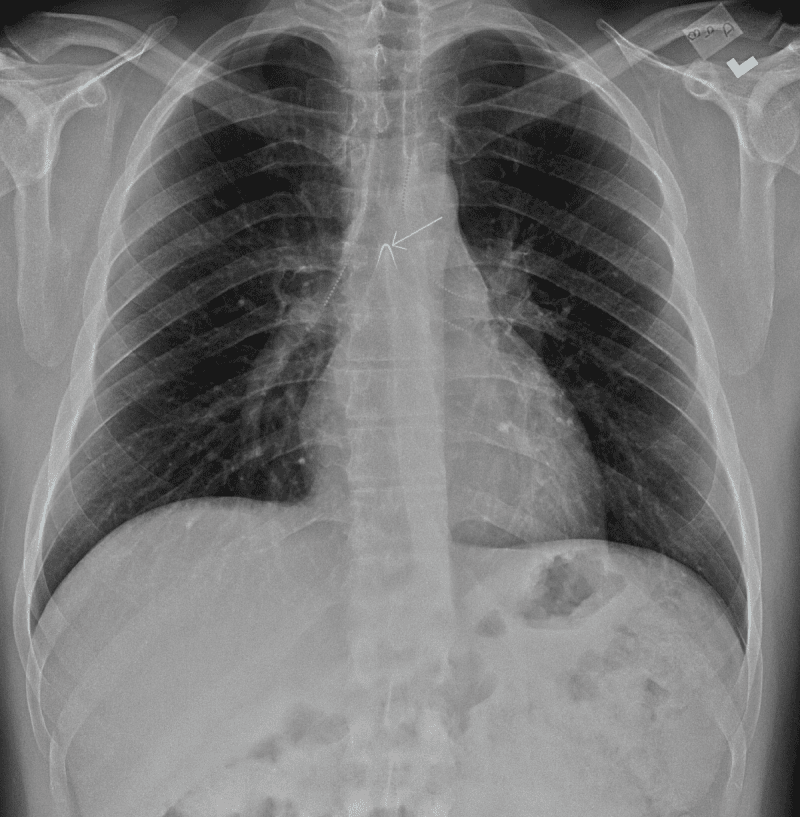 Pulmonary | CaseStacks.com
